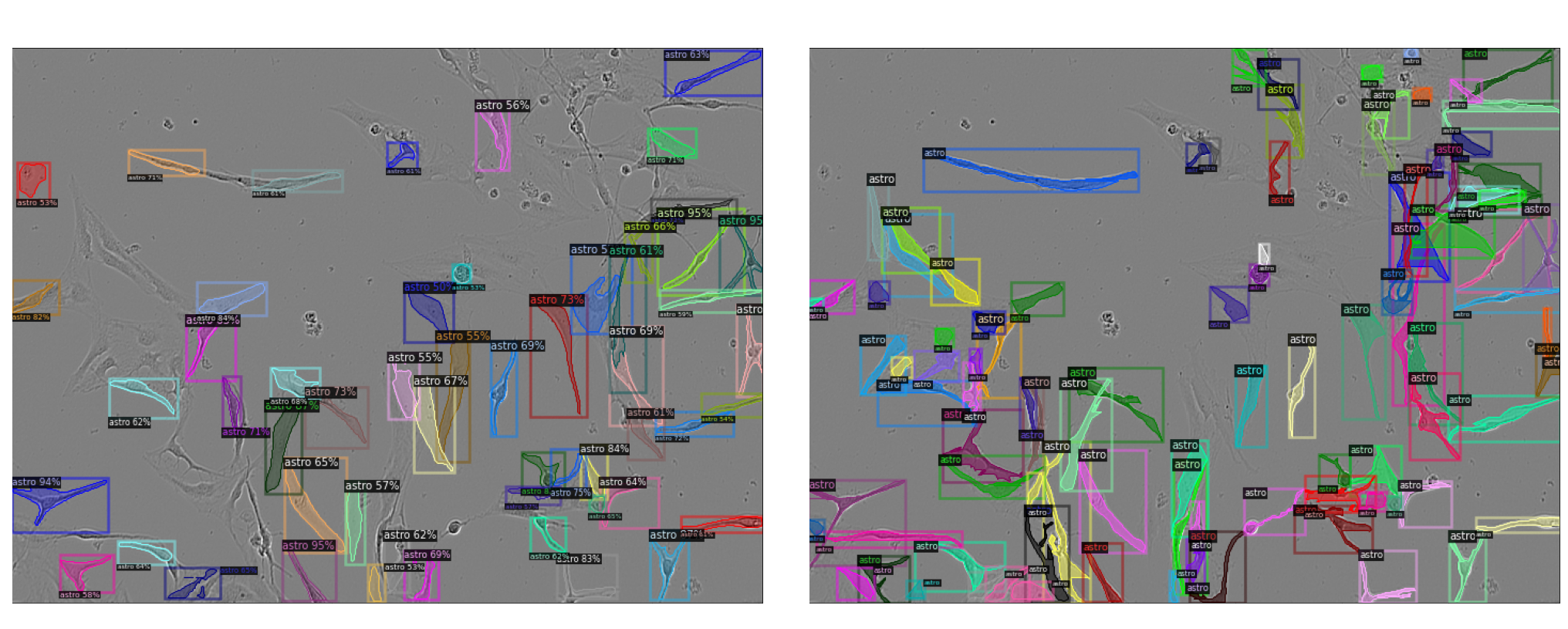 My Machine Learning And Data Science Site Sartorius Cell Segmentation